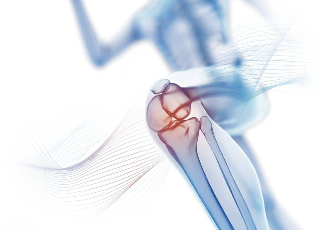 Knee Kinesiography, a Dynamic Knee Exam | KNEEKG®